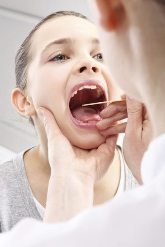 Canker Sore On Tonsil? Here's How To Deal - Health Blog Centre Info